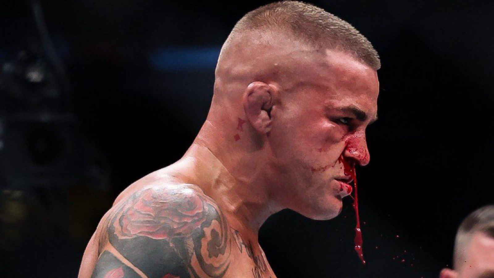 Dustin Poirier reveals several gruesome injuries post-UFC 302 - MMA Weekly