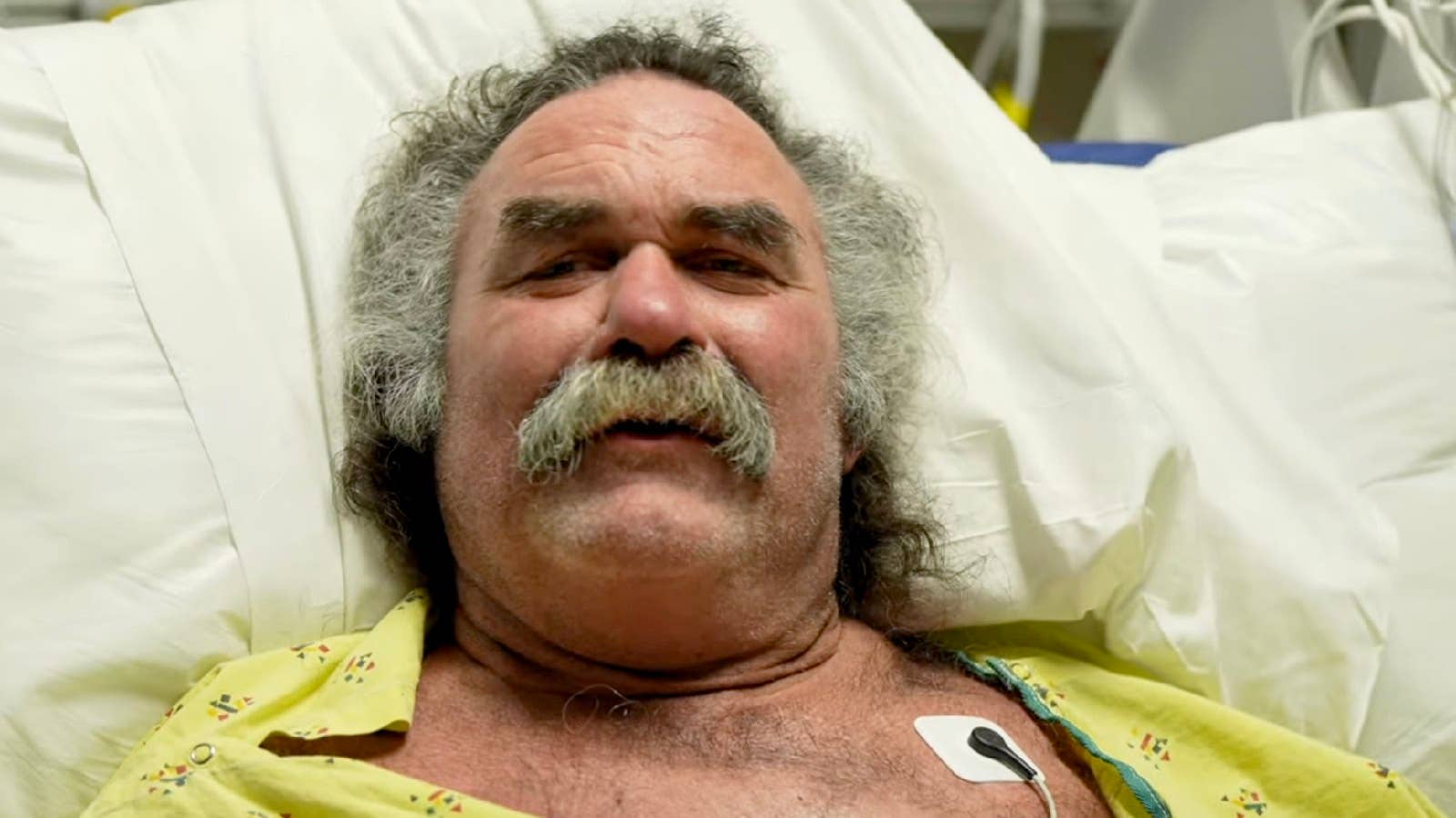 UFC legend Don Frye hospitalized with heart condition - MMA Weekly
