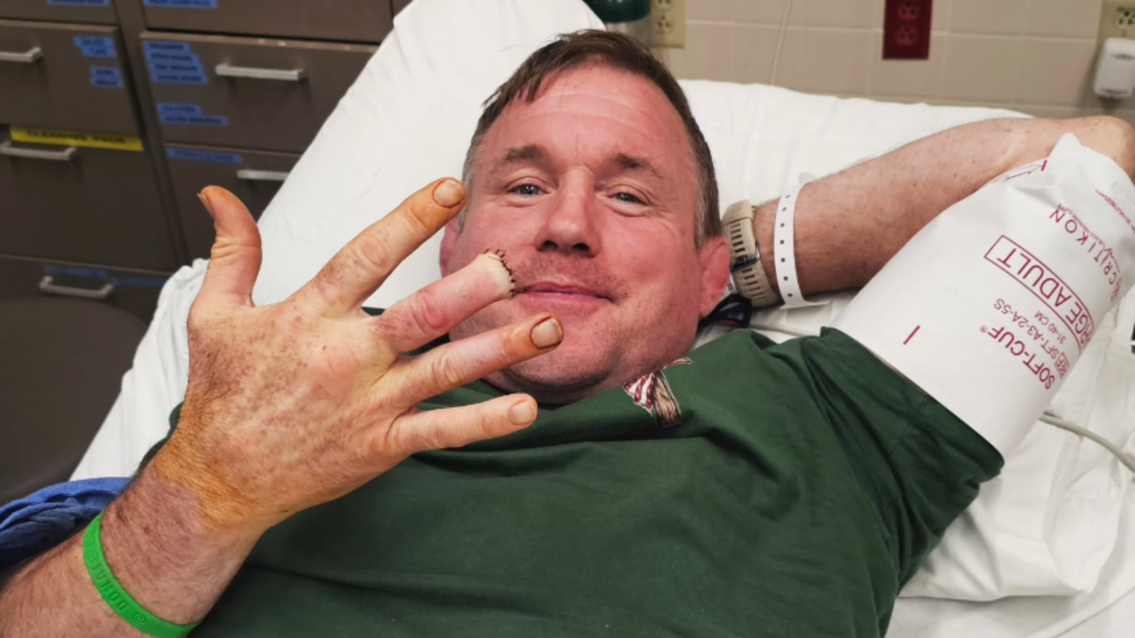 Matt Hughes forced to amputate finger following gory accident - MMA Weekly