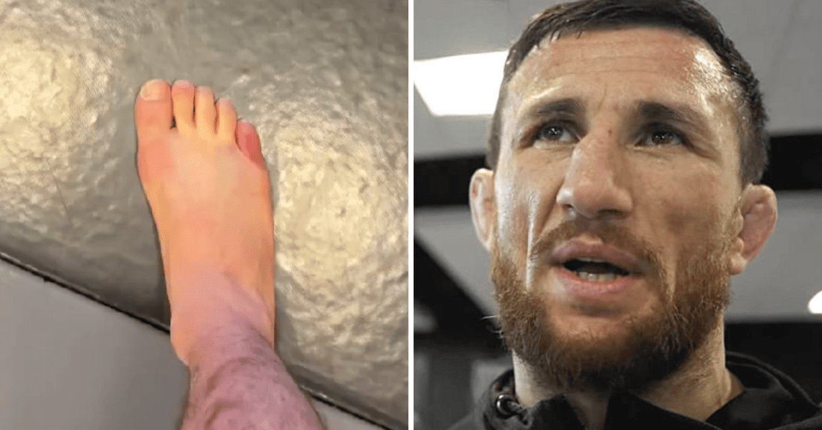 Merab Dvalishvili suffers broken foot days before Sean O'Malley rematch ...