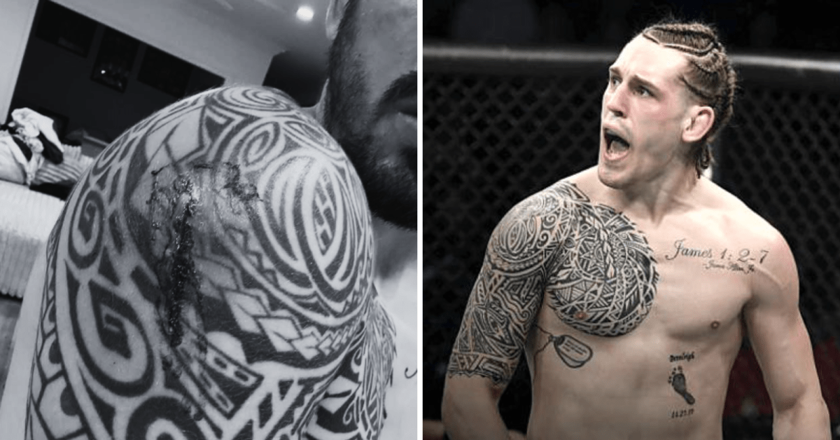 UFC contender riddled with gruesome staph infection - MMAWeekly.com ...