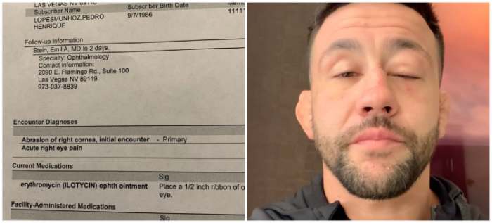 Pedro Munhoz shares medical record following eye injury against Sean O ...