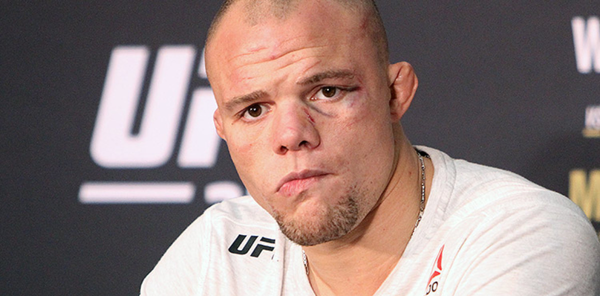 Anthony Smith to require surgery after breaking ankle at UFC 277 ...