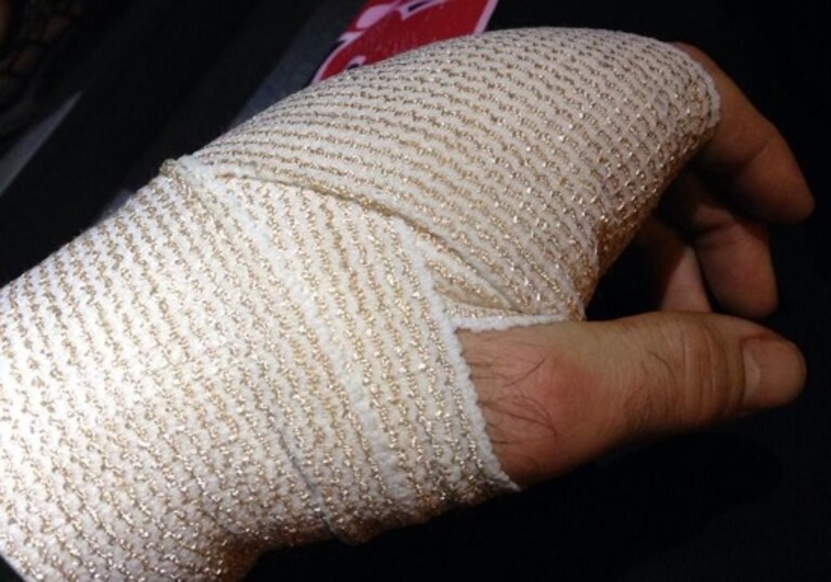 Cole Miller Confirms Broken Hand in UFC Fight Night 35 Bout, Unsure of ...