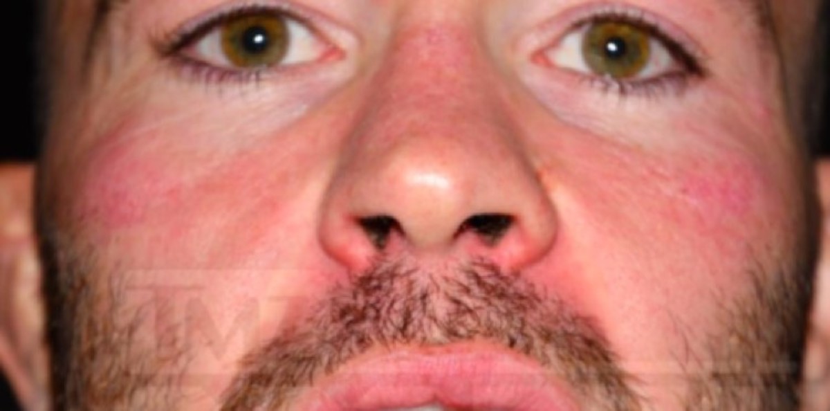 Photo emerges of Colby Covington's broken tooth from alleged Jorge ...