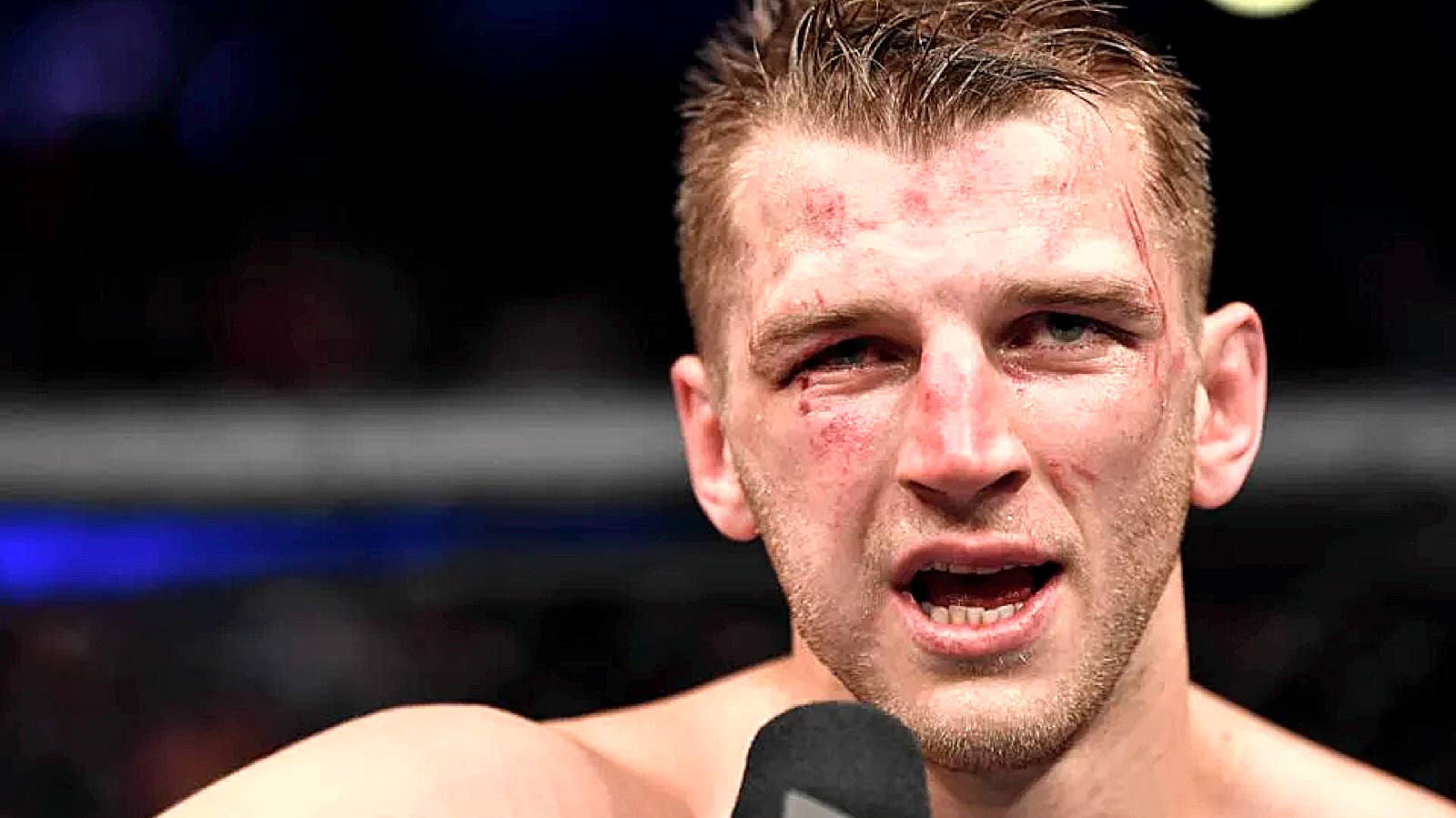 Dan Hooker responds to allegations amid family feud - MMA Weekly