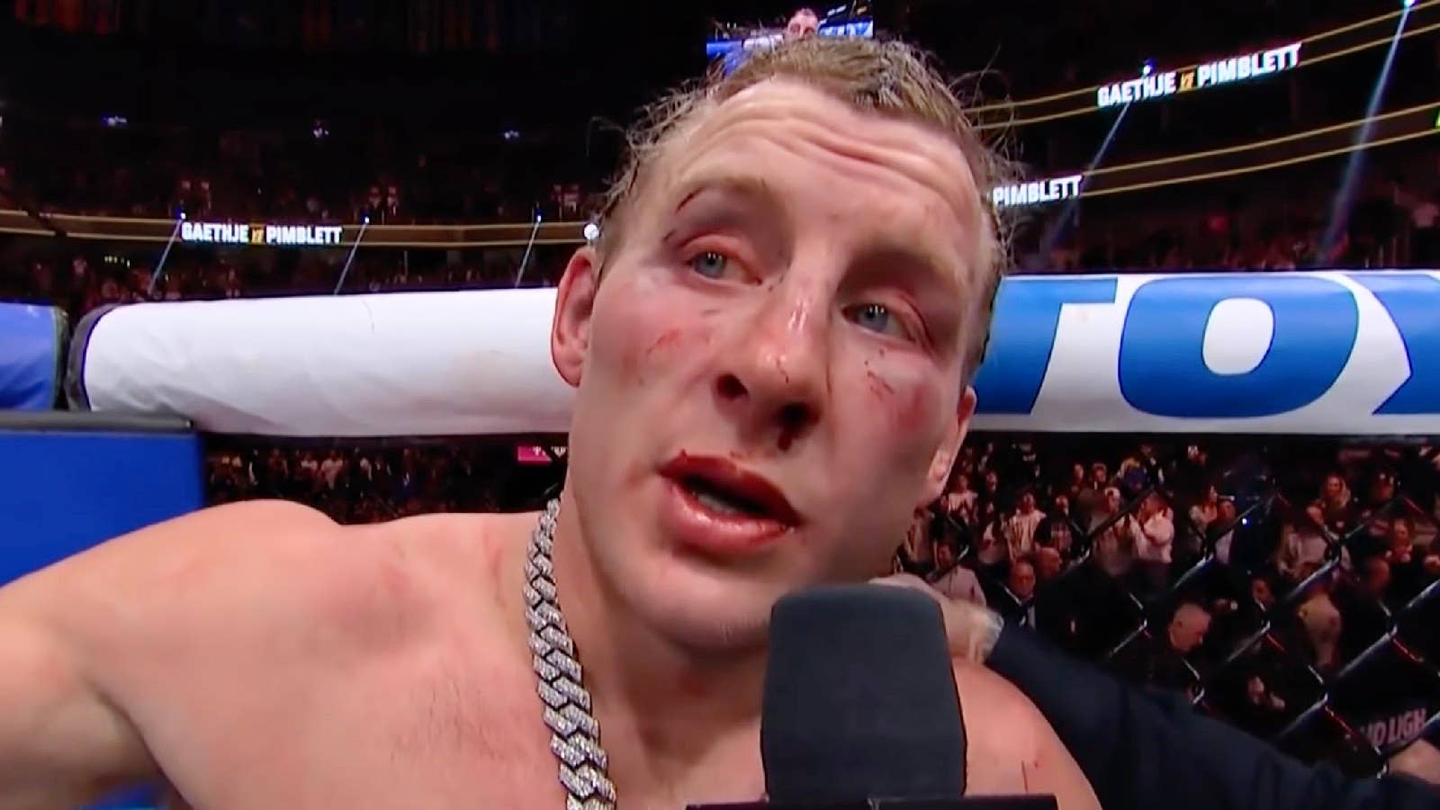 Paddy Pimblett claims he suffered scratched cornea during UFC 324 ...
