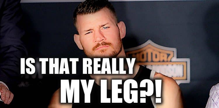 Check Out Michael Bisping's Post-Surgery Elephant Leg (pic) - MMA Weekly